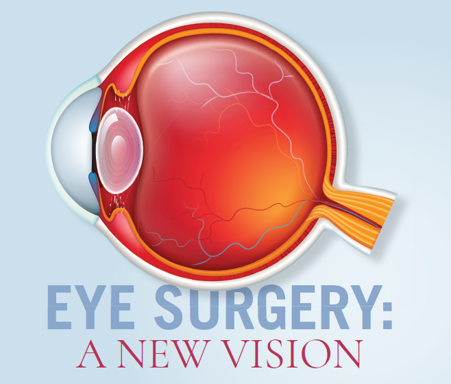 Eye Surgery: A New Vision